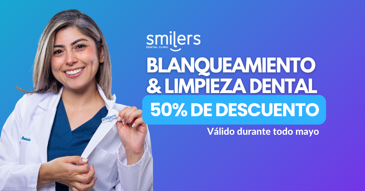 Smilers 50% en blanqueamiento dental incluye limpieza